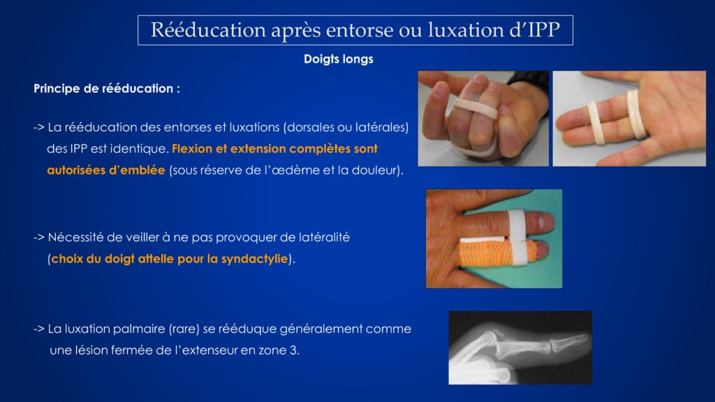 entorse-doigt-entorse-doigt-entorse-doigt - Denis GERLAC - Rééducation ...