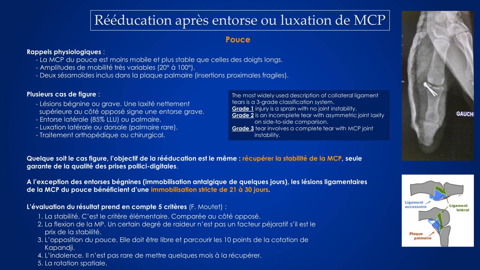 entorse-pouce-entorse-pouce-reeducation-reeducation-1 - Denis GERLAC ...