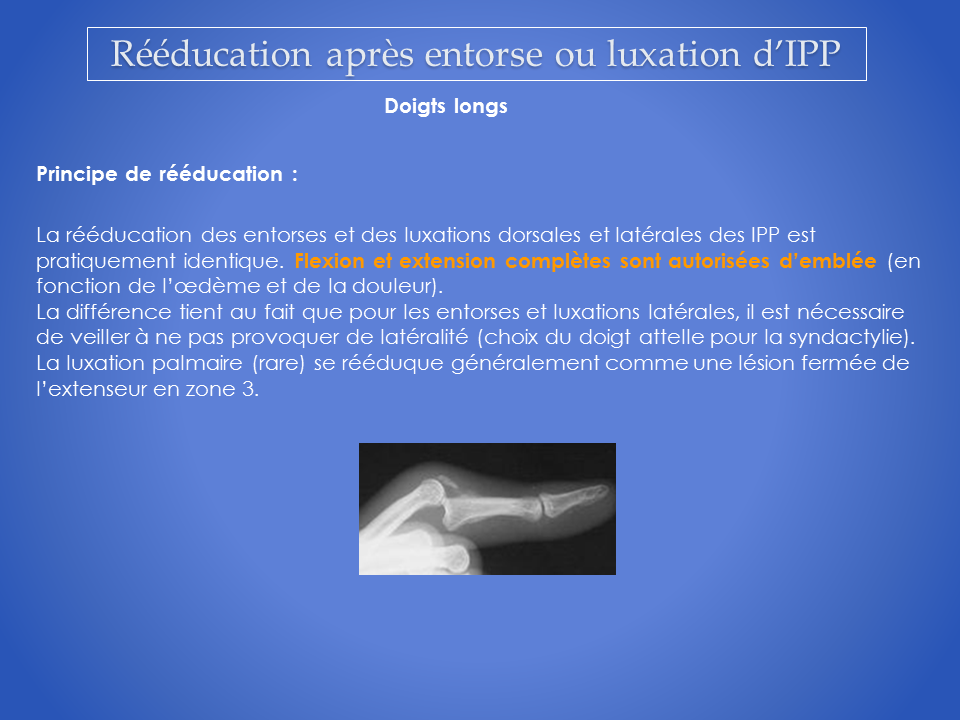 Rééducation après luxation de doigt (IPP) - Denis GERLAC - Rééducation ...