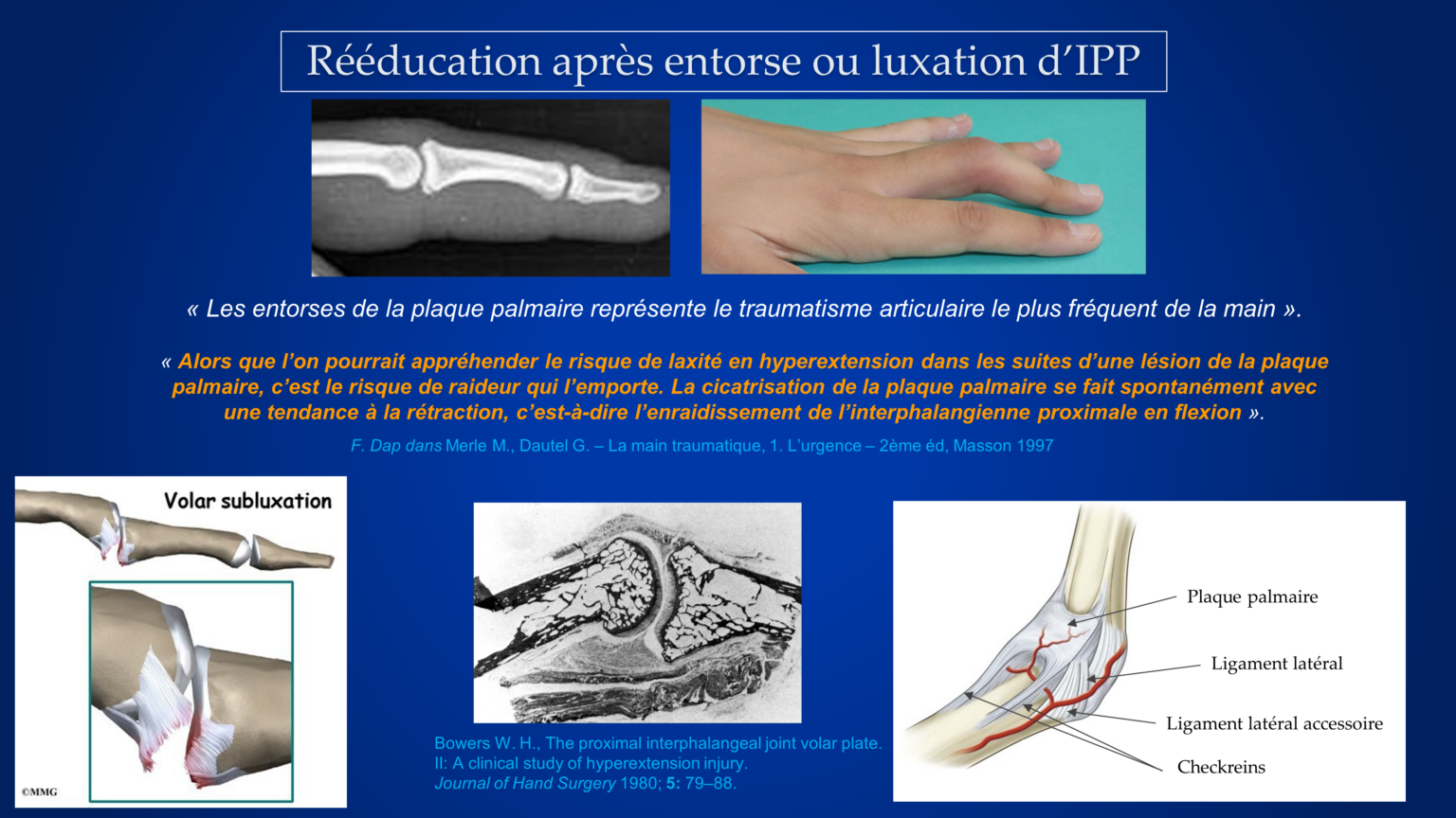 luxation-doigt-que-faire-luxation-doigt-que-faire - Denis GERLAC ...