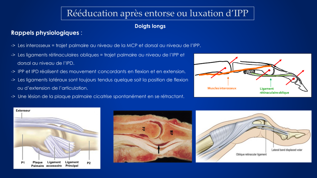 luxation-doigt-traitement-luxation-doigt-traitement - Denis GERLAC ...