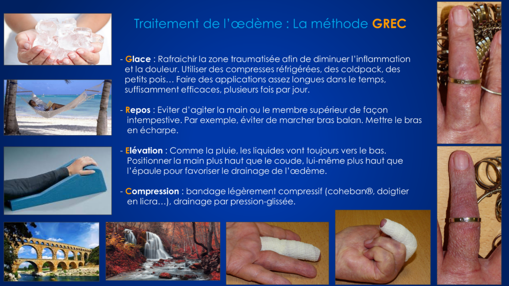 traitement-doigt-entorse-traitement-doigt-entorse - Denis GERLAC ...